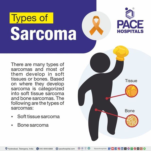 Ewing Sarcoma: Causes, Symptoms, And Treatment – BUVJY